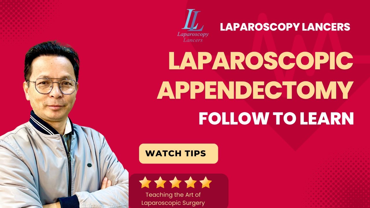 Laparoscopic Appendix Surgery - be it emergency or elective, an Appendix deserves laparoscopy ...