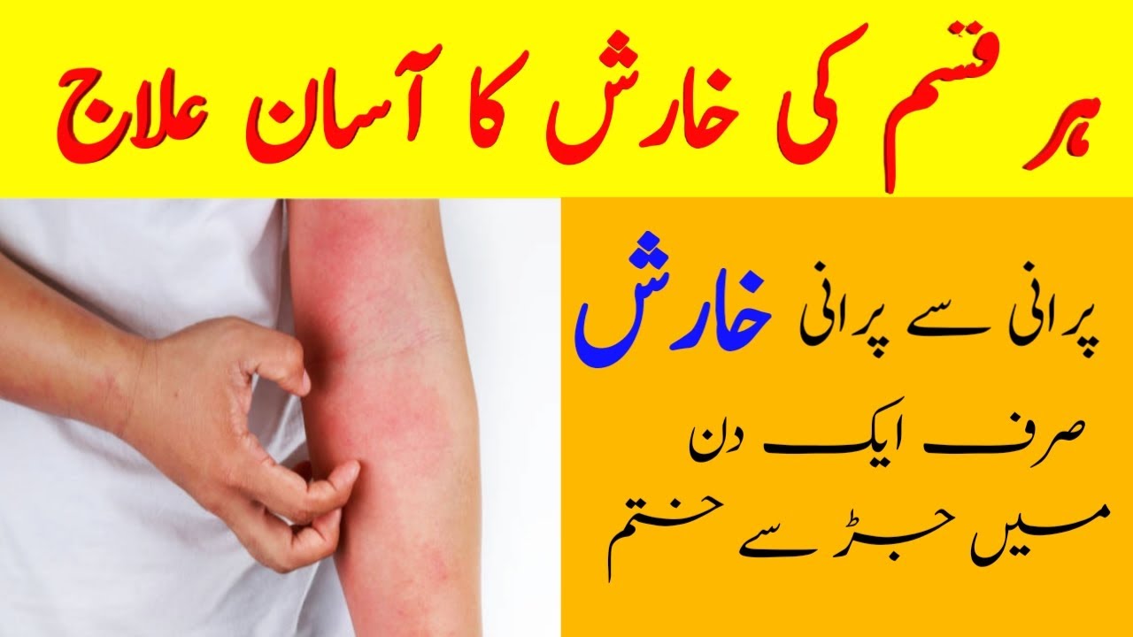 Kharish Ka ilaj | Kharish Khatam Karne Ka Tarika | Allergy Ka ilaj ...