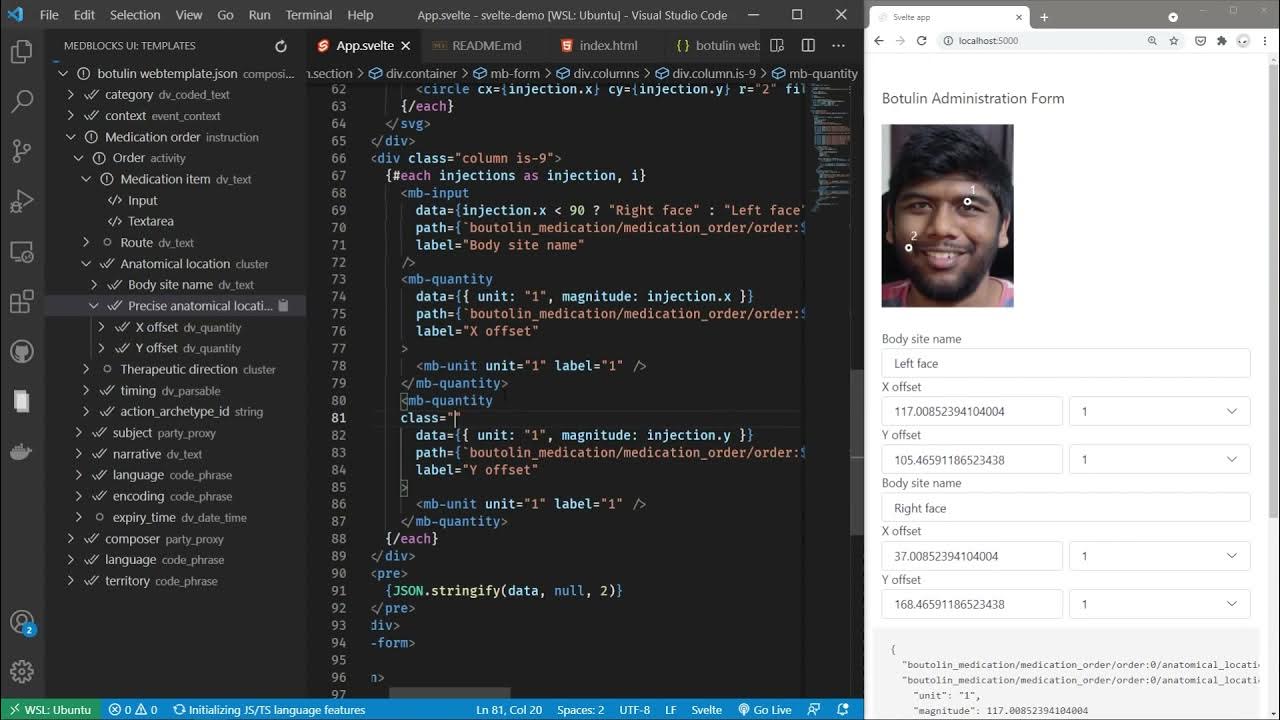 Medblocks UI - openEHR Asia conference Full Demo (no audio) - YouTube