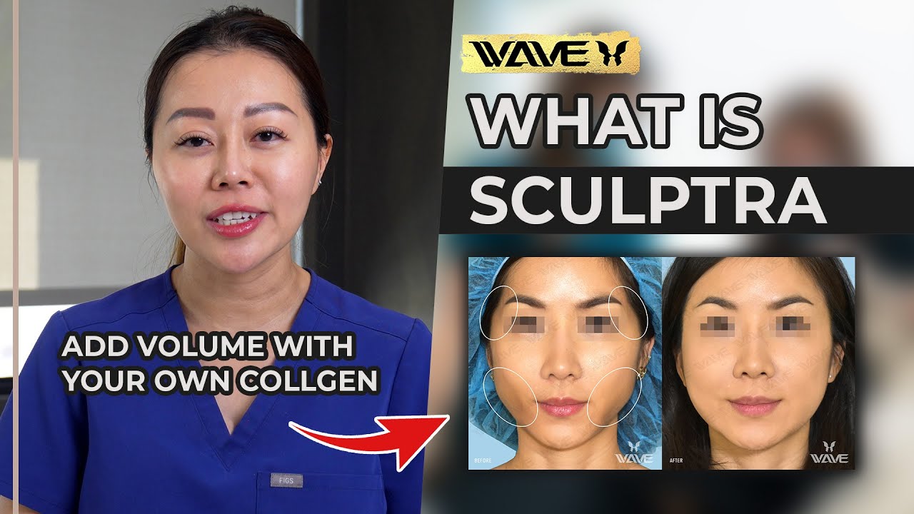 Sculptra: The Secret to Firmer Skin! | Wave Plastic Surgery - YouTube
