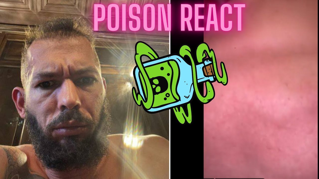 Andrew Tate Suffering with Poison #andrewtate #andrew #tristantate # ...