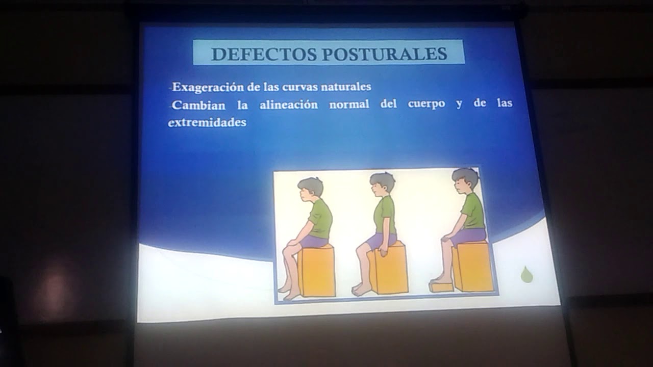 Medicina Física y Rehabilitación - Defectos Posturales 1/2 - YouTube