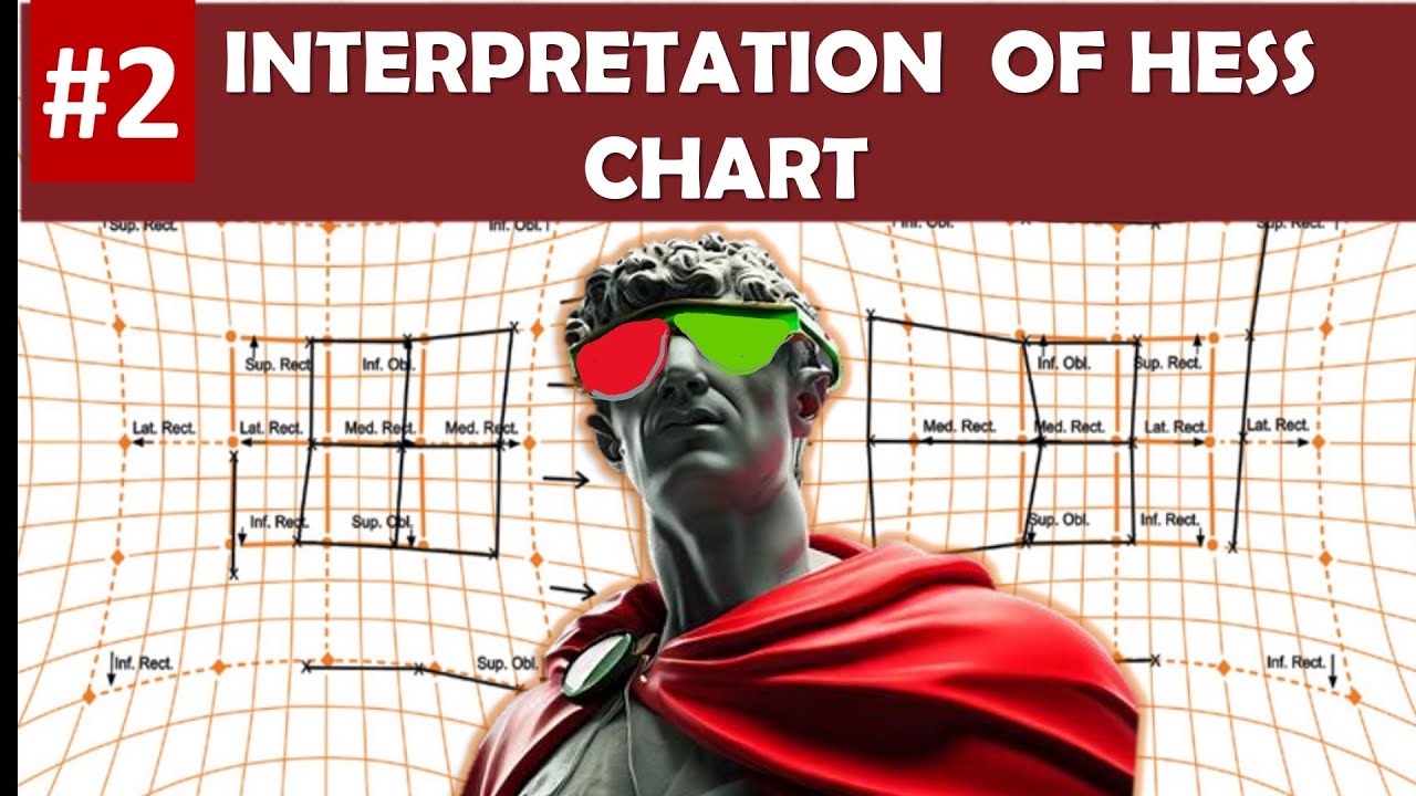Interpreting HESS CHART : Herrings, Sherrington's Law, Muscle sequelae ...