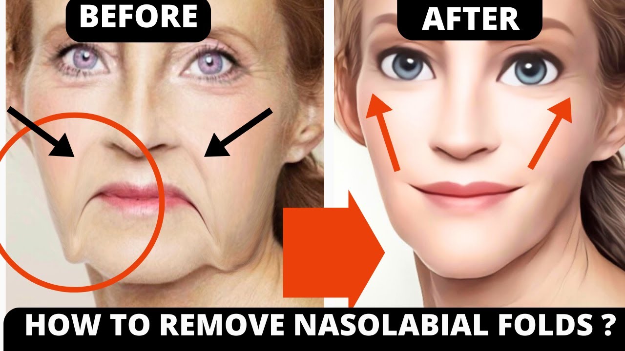 Smooth Nasolabial Folds Naturally | Face Yoga for Youthful Skin - YouTube