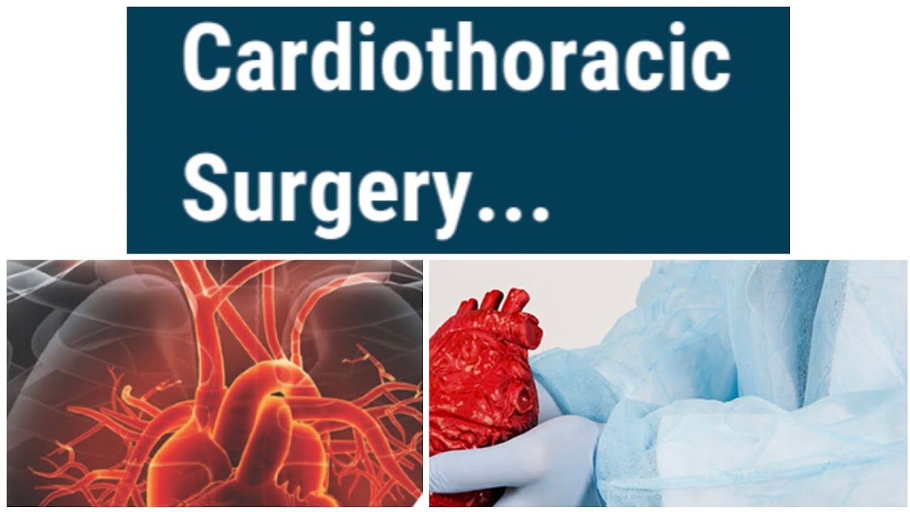 Cardiothoracic Surgery | Aortic Dissection, Thoracic Outlet Syndrome ...