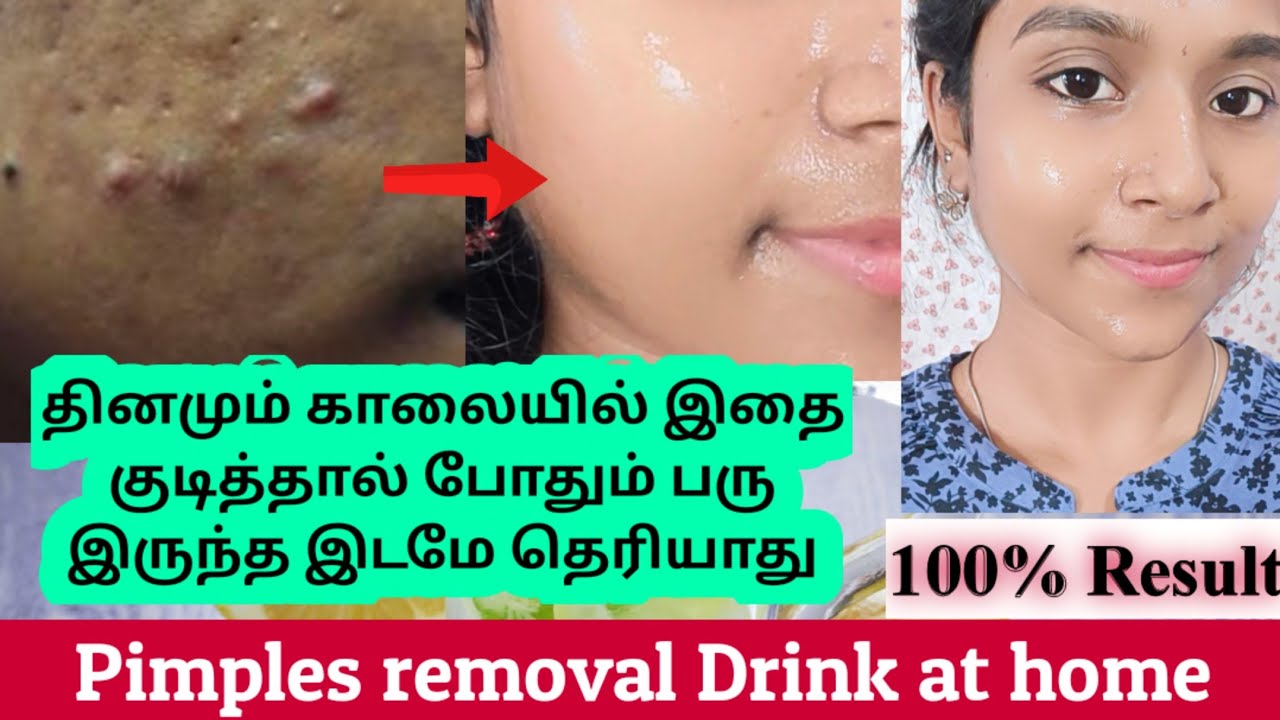 permanent Pimples removal drink at home/get even skin tone everyday ...