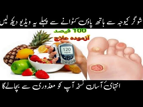 Herbal Remedies for Cuts and Wounds Caused by Diabetes،shugar k zakham ...