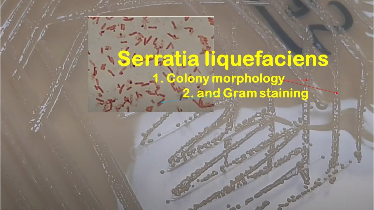 Serratia Marcescens Gram Stain
