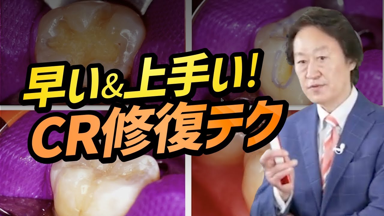 「保険 × 高速」でCR修復を行うテクを伝授します - YouTube