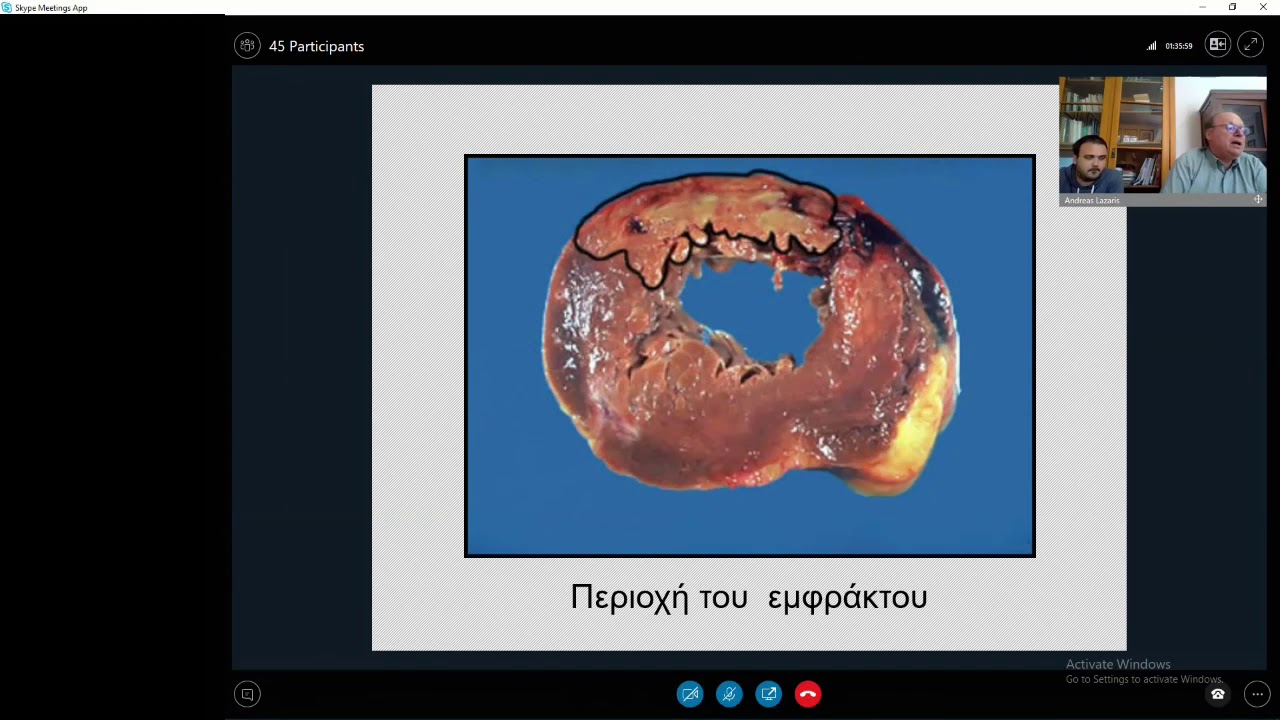 06 Γ ΜΕΡΟΣ ΚΛΙΝΙΚΟ ΠΑΘΟΛΟΓΟΑΝΑΤΟΜΙΚΟΥ ΦΡΟΝΤΙΣΤΗΡΙΑΚΟΥ ΜΑΘΗΜΑΤΟΣ ΓΙΑ ΤΙΣ ...