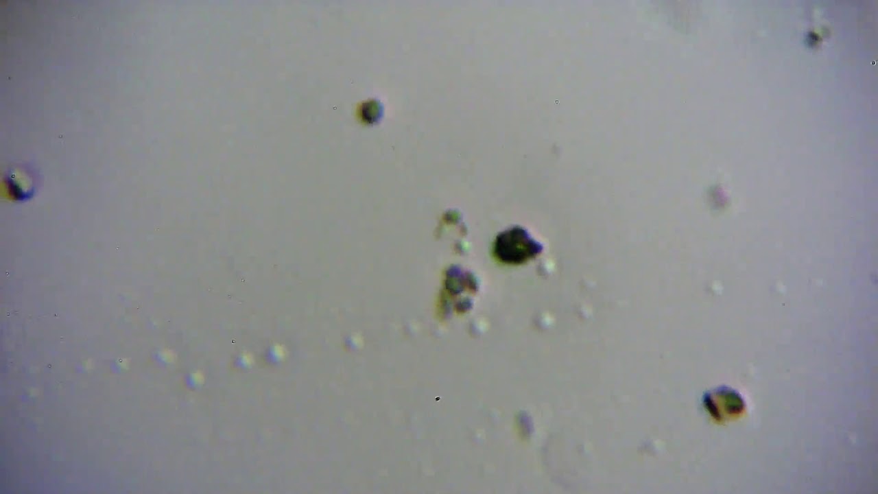 Time Lapse Of Bacteria Swimming 2500X - YouTube