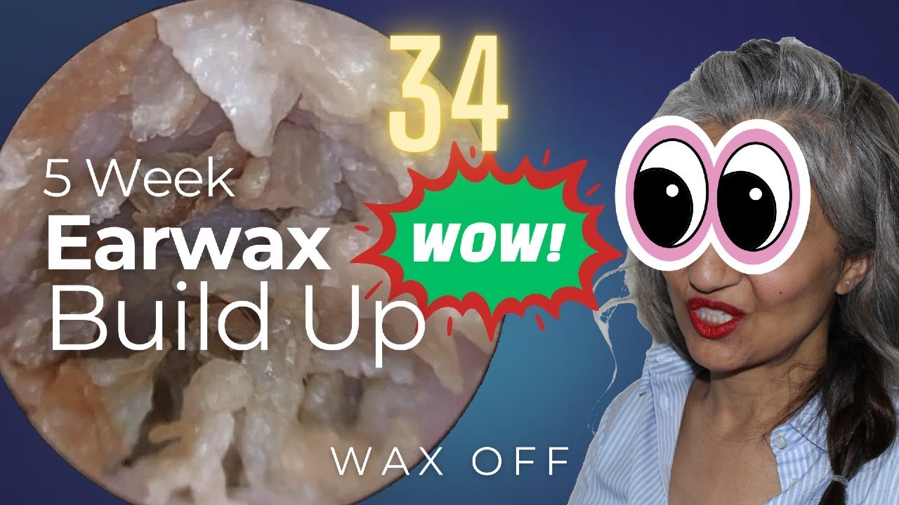 5 Week Earwax Build Up | Wax Off Episode 34 - YouTube