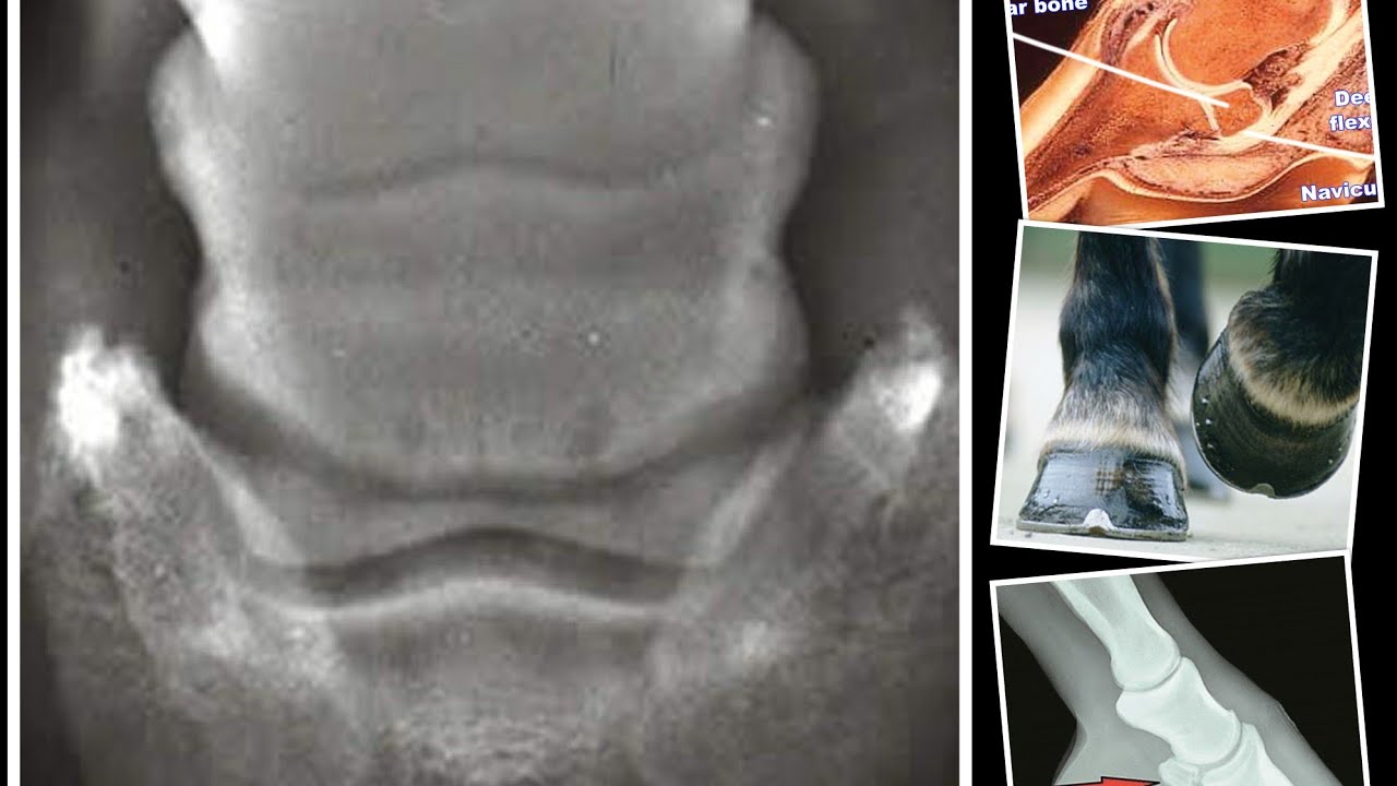 NAVICULAR DISEASE IN HORSES - YouTube