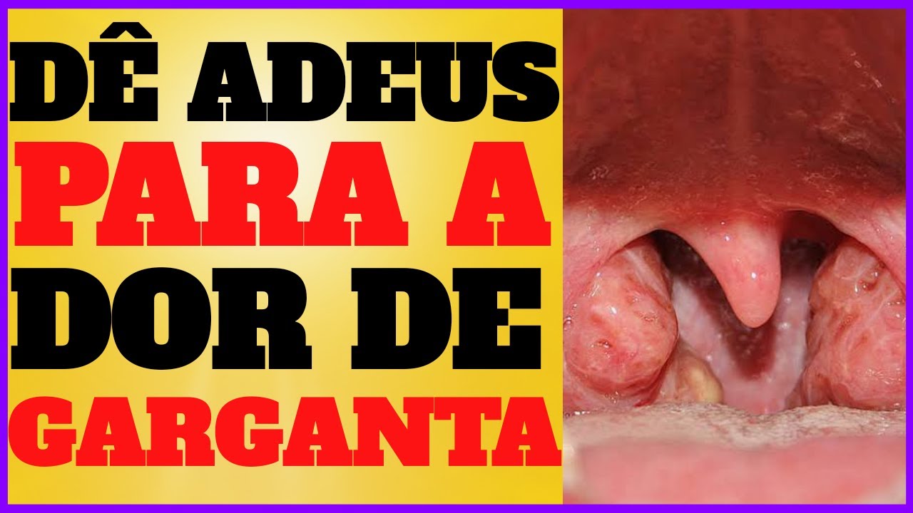 REMÉDIO CASEIRO para DOR de GARGANTA INFLAMADA - como curar a garganta ...