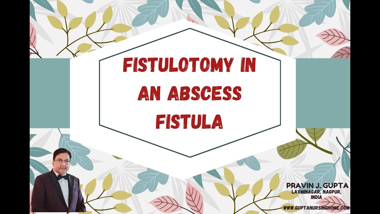 A COMPLEX ANAL FISTULA TREATED WITH A DRAINING SETON - YouTube