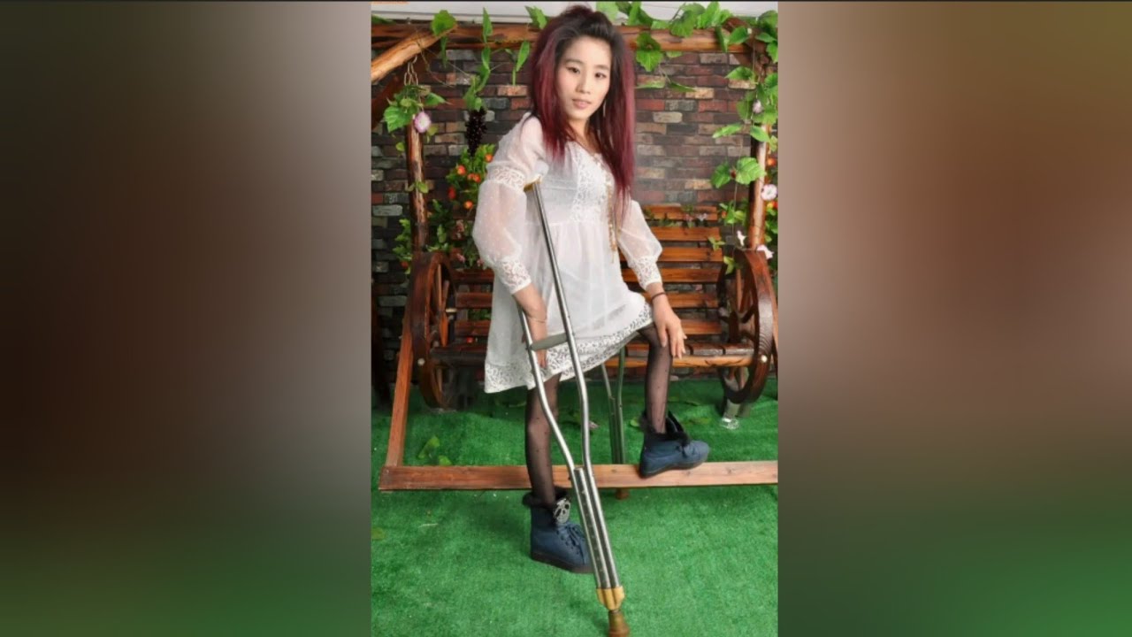 The beautiful woman with polio walks on crutches #polio - YouTube