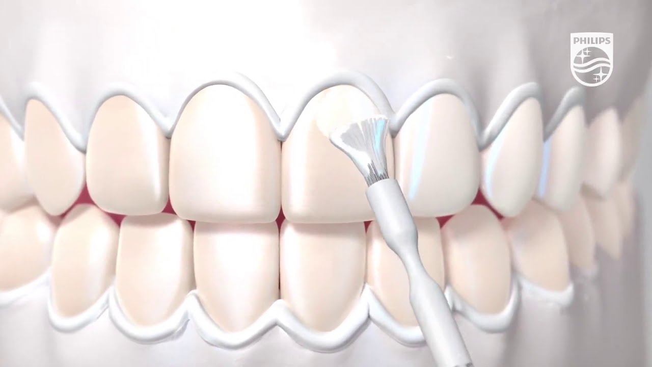 Zoom WhiteSpeed Light-Activated Whitening - YouTube