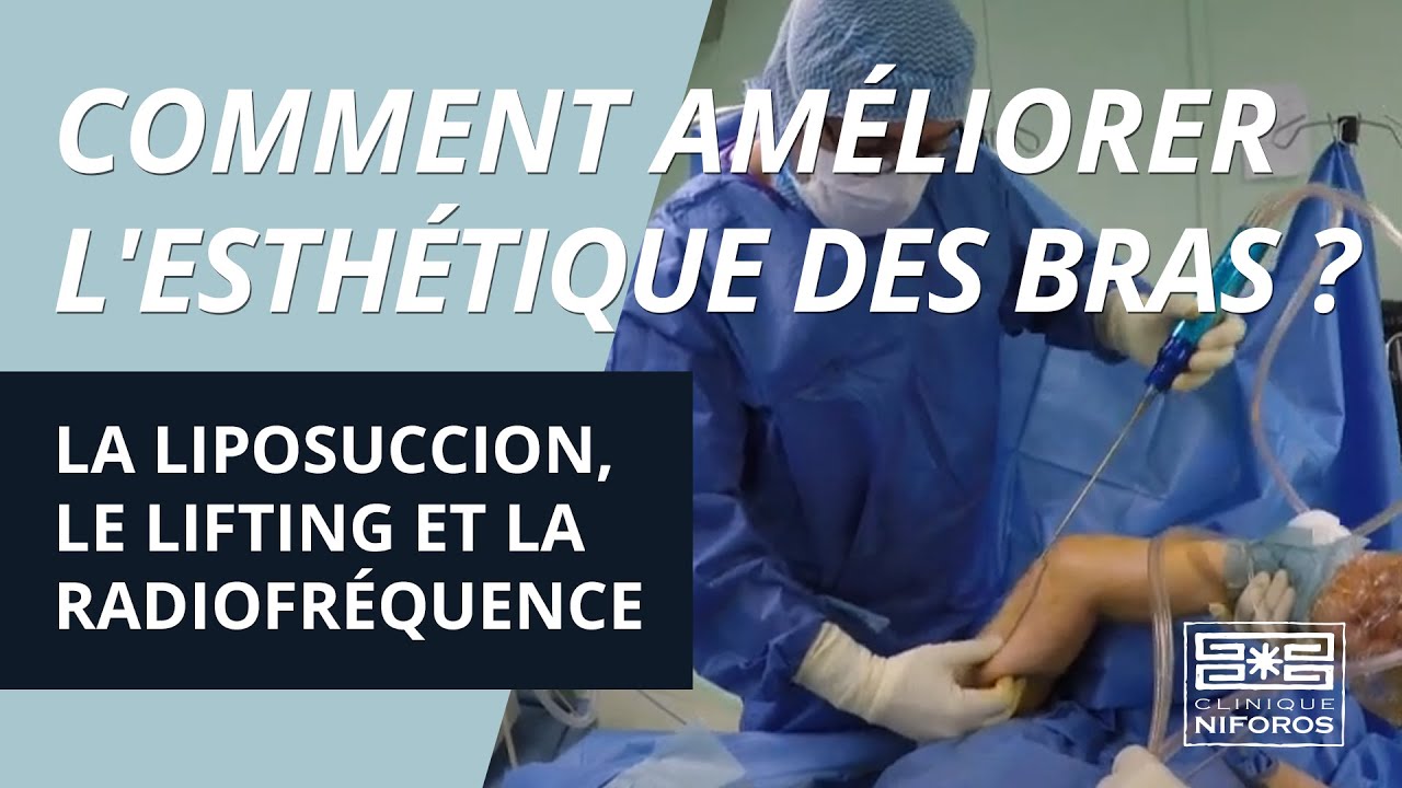 Comment améliorer l'esthétique du bras par la liposuccion, lifting et ...