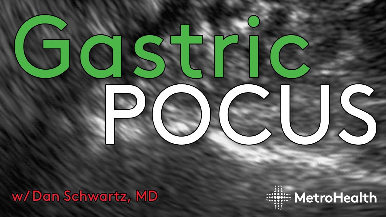 Gastric POCUS - YouTube