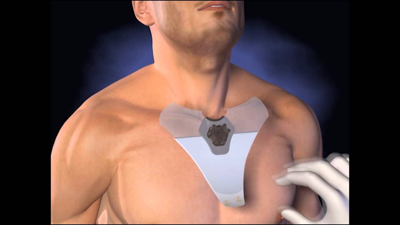 TALON Animation CMS - YouTube