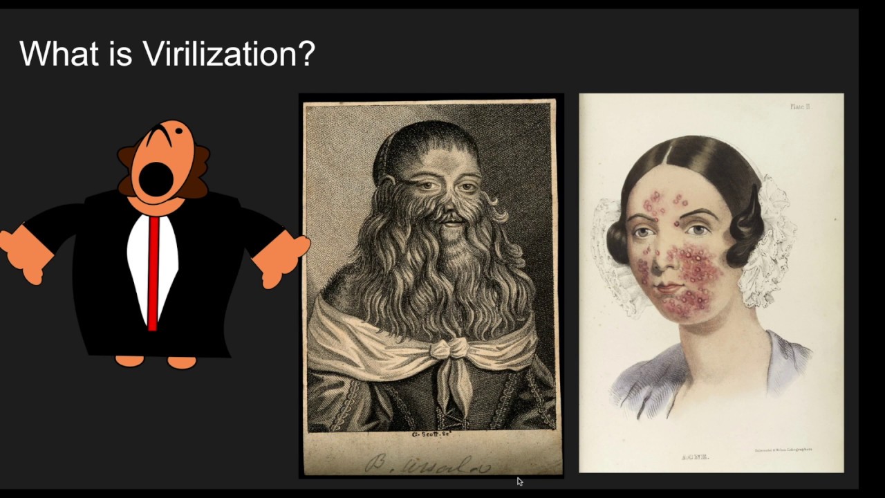 OBGYN #1: Virilization - YouTube