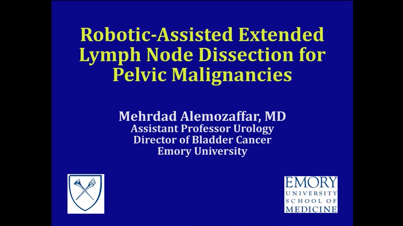 Core Videos (2018): Robotic Assisted Extended Lymph Node Dissection for ...