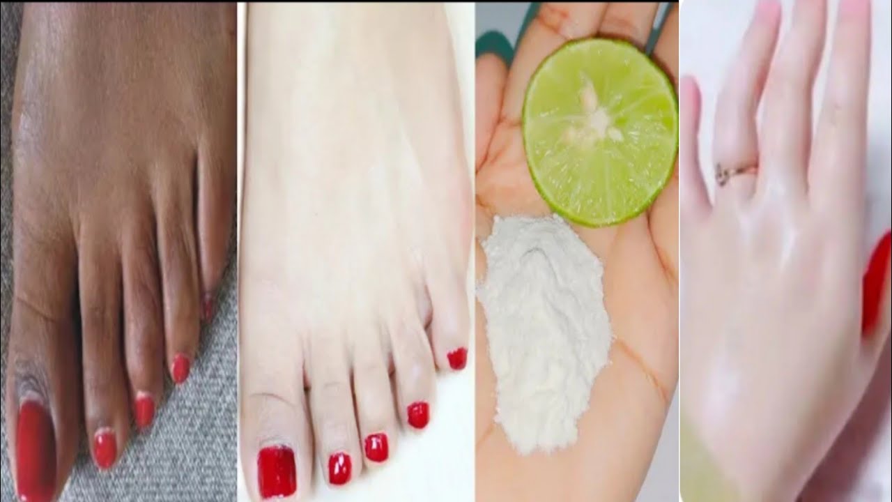 Foot whitening home remedies | How to get fair legs at home | Feet ...