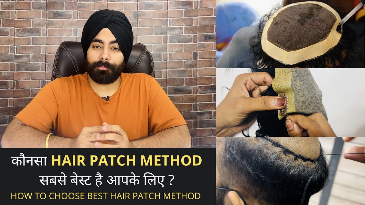 How To Choose Best Hair Replacement Method For You | Full information ...