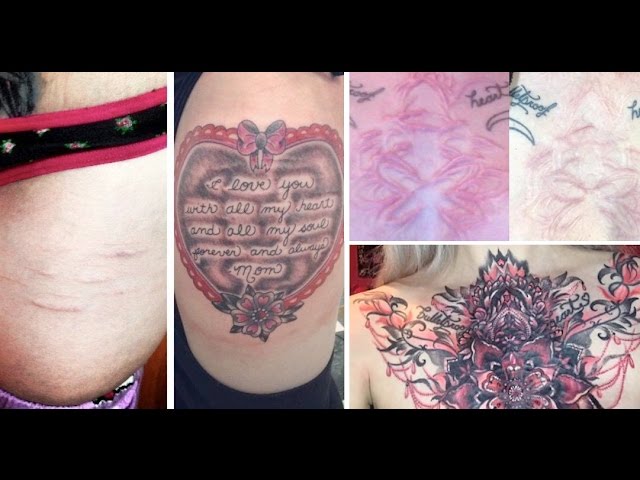 Scarification Gone Wrong