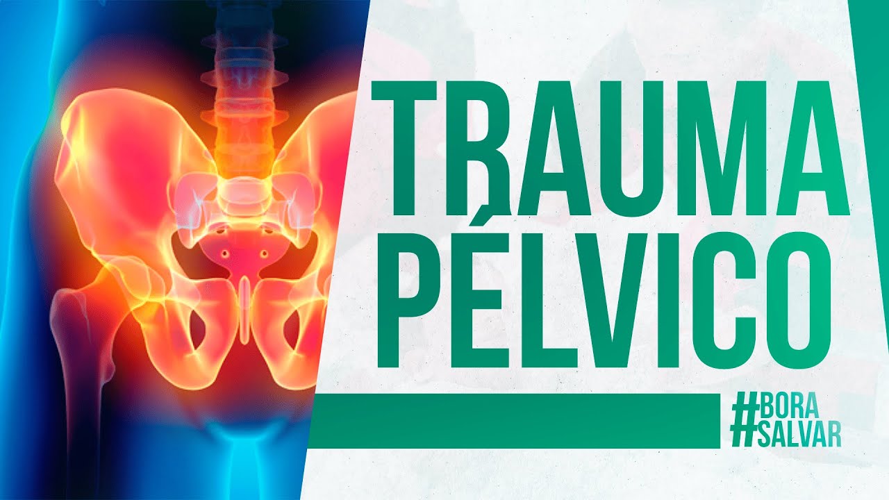 TRAUMA PÉLVICO: Visão clínica primordial para o plantão - YouTube
