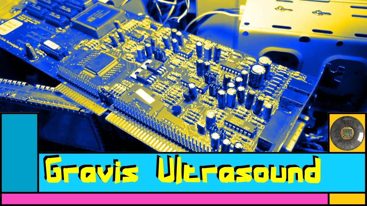 The Real Gravis Ultrasound Experience - YouTube
