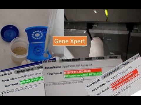 GeneXpert introduction, procedure and its application - YouTube