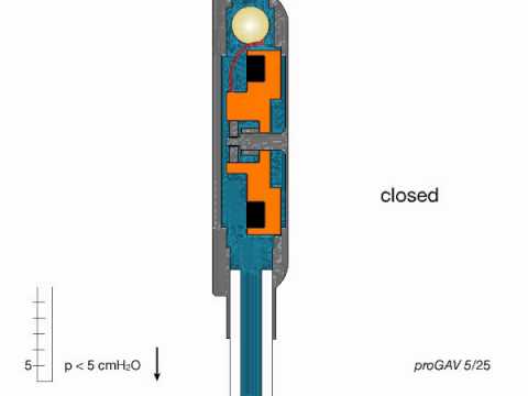 proGAV Animation - YouTube