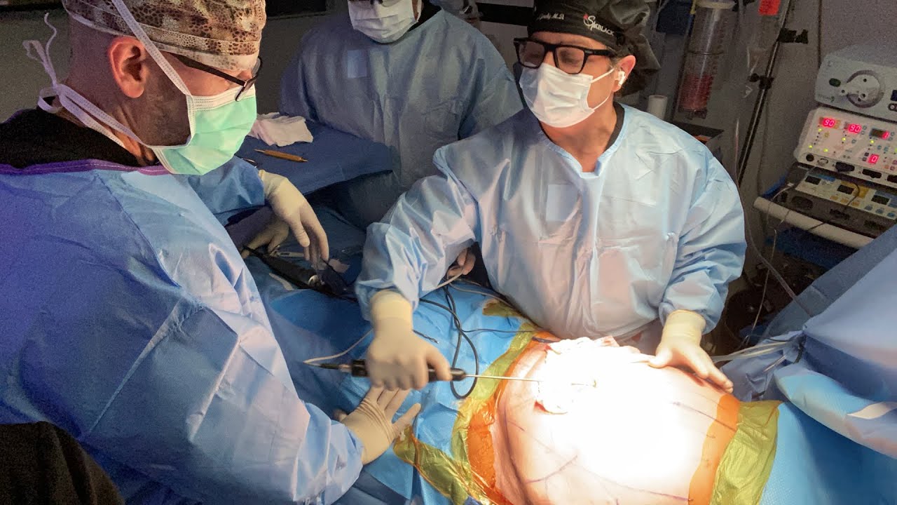Tummy tuck surgery | Dr Boom Boom Pow - YouTube