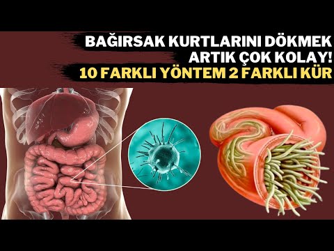 BAĞIRSAK KURTLARINI DÖKMENİN EN KOLAY 10 DOĞAL YOLU - Bağırsak Kurdu (Kıl Kurdu) Nasıl Dökülür?