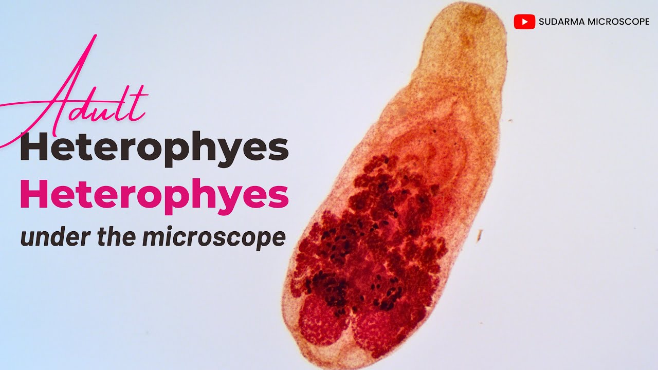Adult Heterophyes heterophyes under the microscope - YouTube