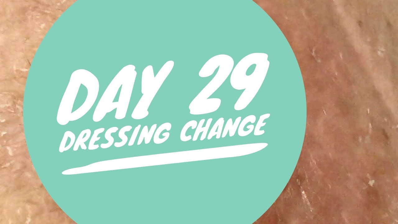 Day 29 Abscess Dressing Change! - YouTube