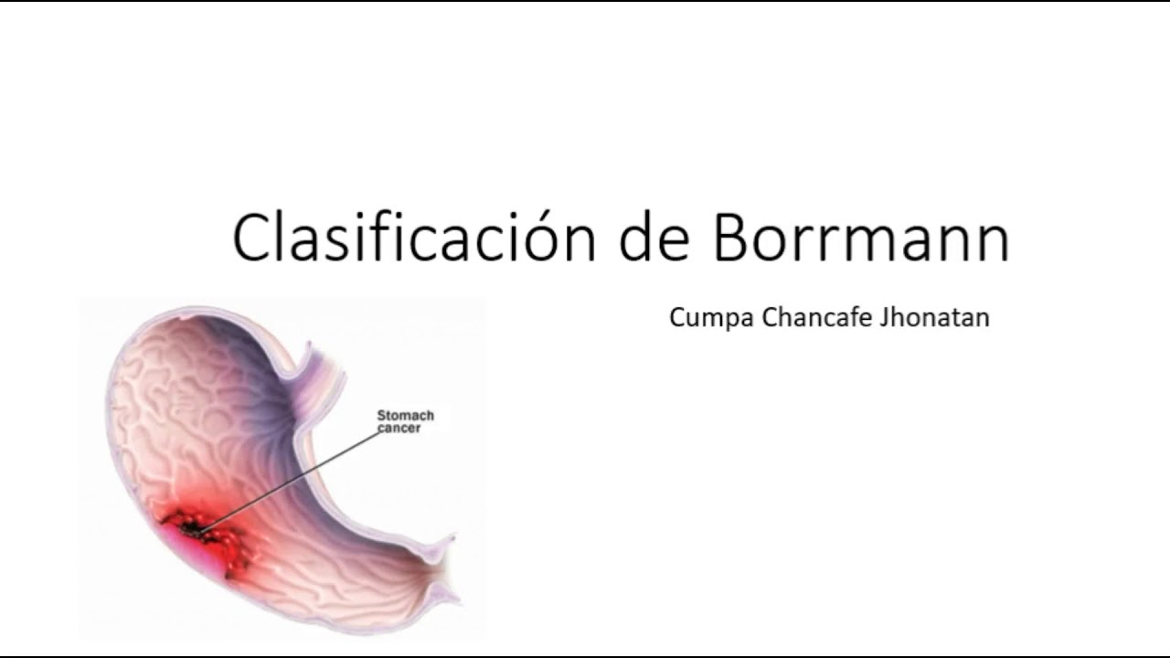 Clasificación Borrmann - YouTube