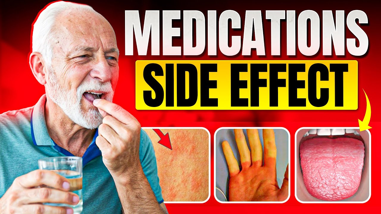 Medications With Weird Side Effects | Strange Drug Reactions Explained ...