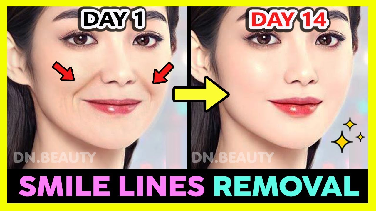 ELIMINACIÓN Y RELLENO DE LÍNEAS DE SONRISA (LÍNEAS DE LA RISA) CON EJERCICIO Y MASAJE CARA ...