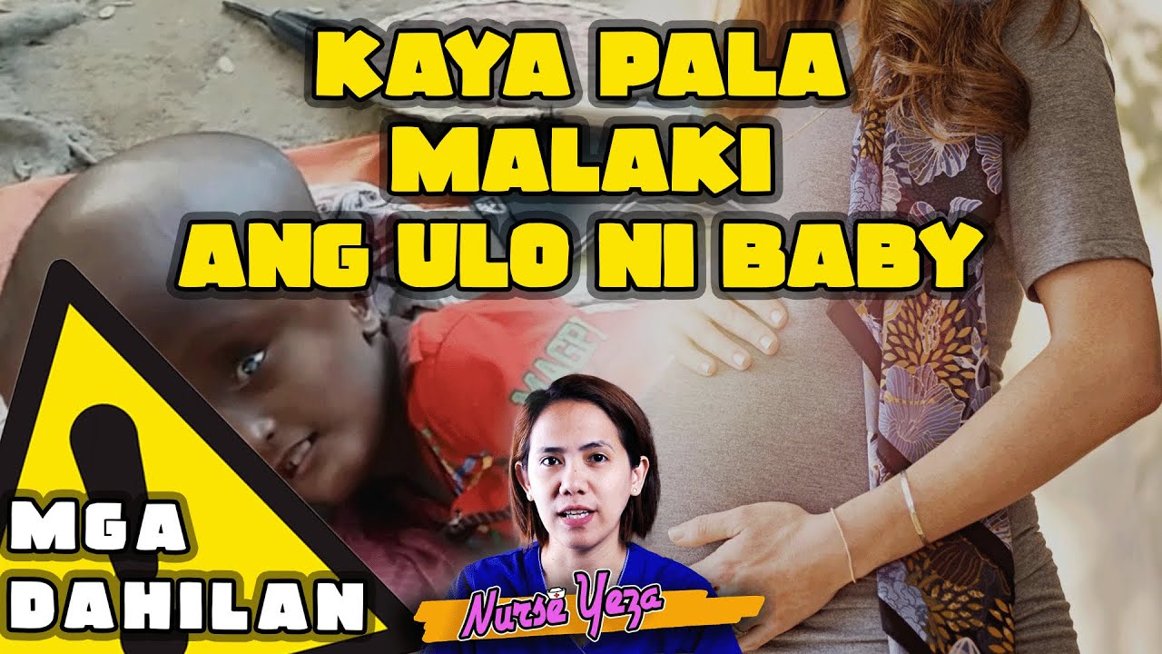 DAHILAN NA MALAKI ANG ULO NI BABY - YouTube