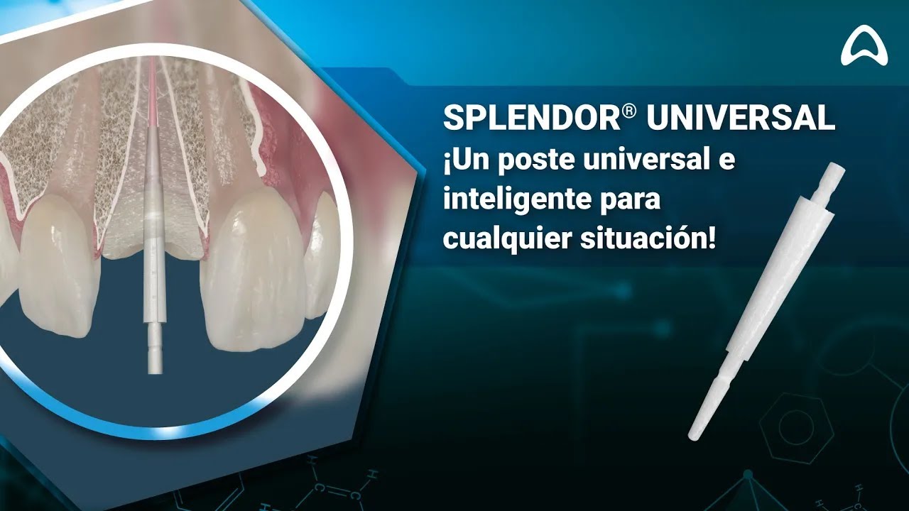 Splendor® Universal - ¡Un poste inteligente para cualquier situación ...