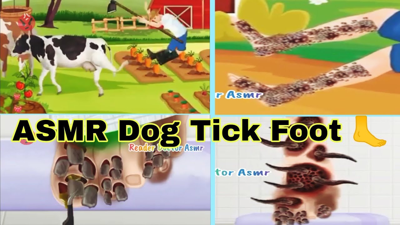ASMR Removal Tick from Foot/ Dogs Ticks & Maggot infected foot. - YouTube