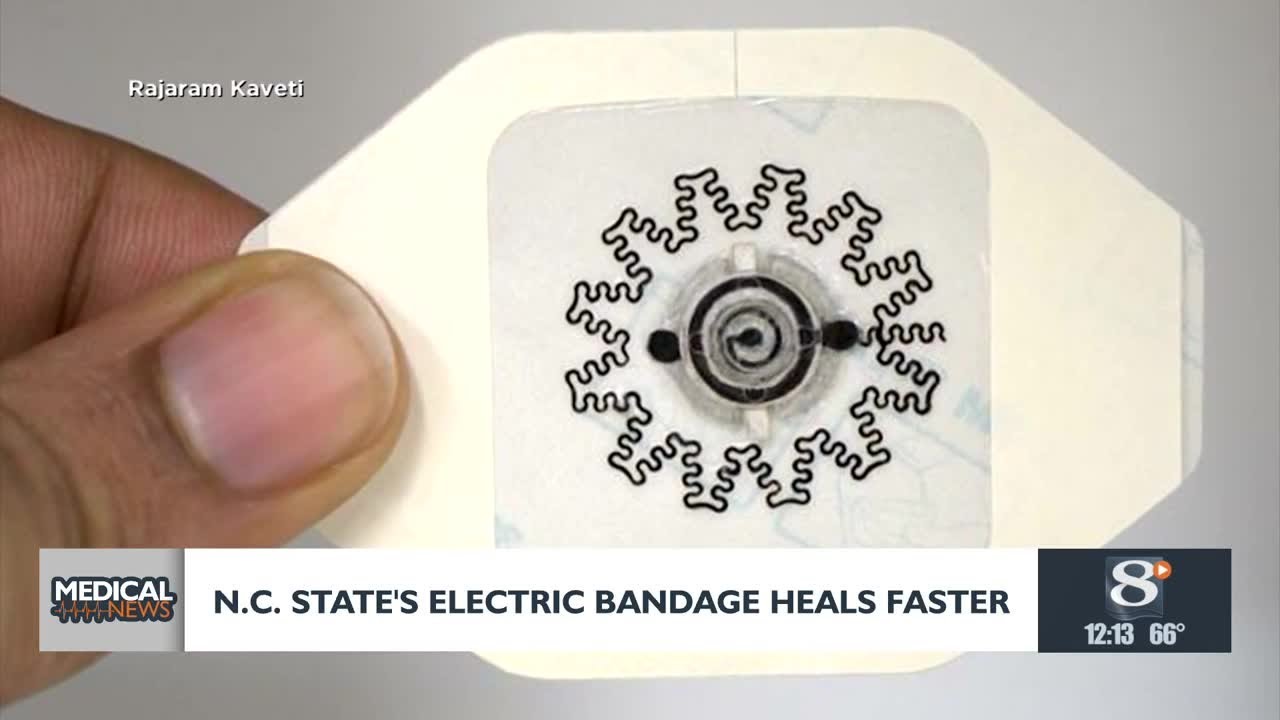 NC State develops electric bandage - YouTube