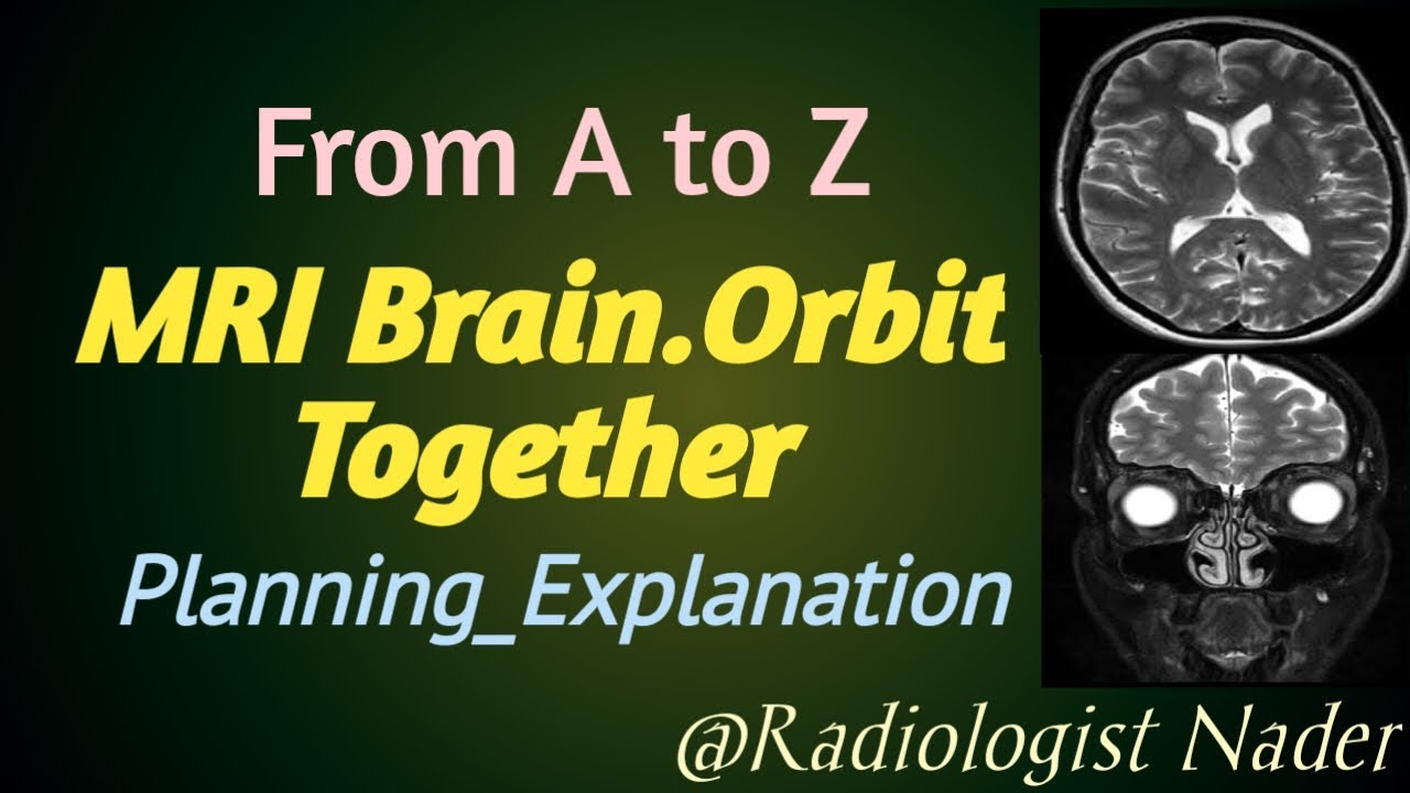 رنين مغناطيسي علي المخ وحجاج العين|تخطيط|شرح|MRI Brain&Orbit - YouTube