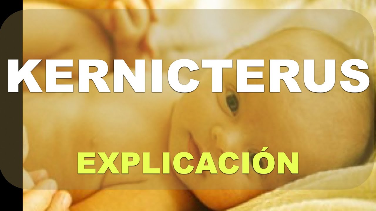 Qué es el kernicterus - YouTube
