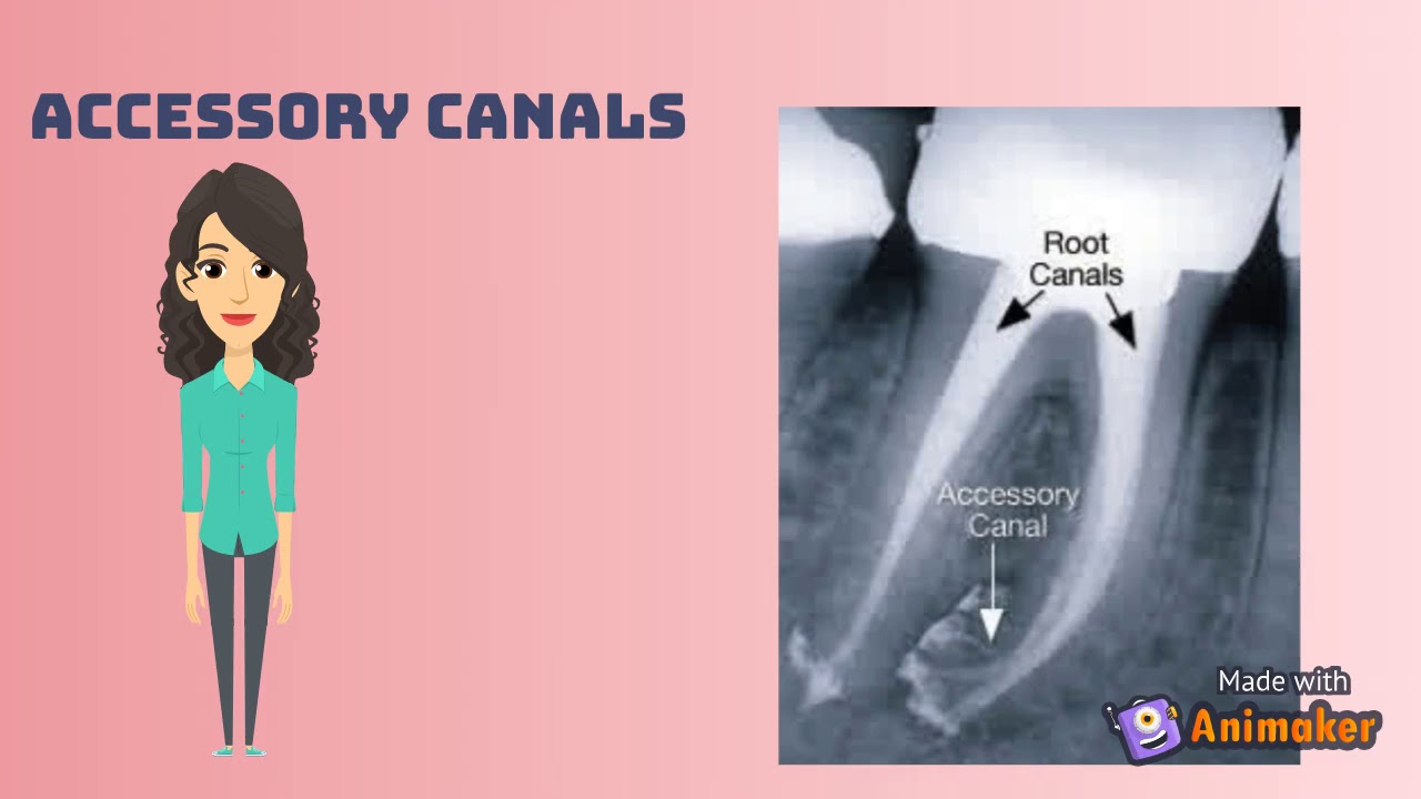 Root Canals - YouTube
