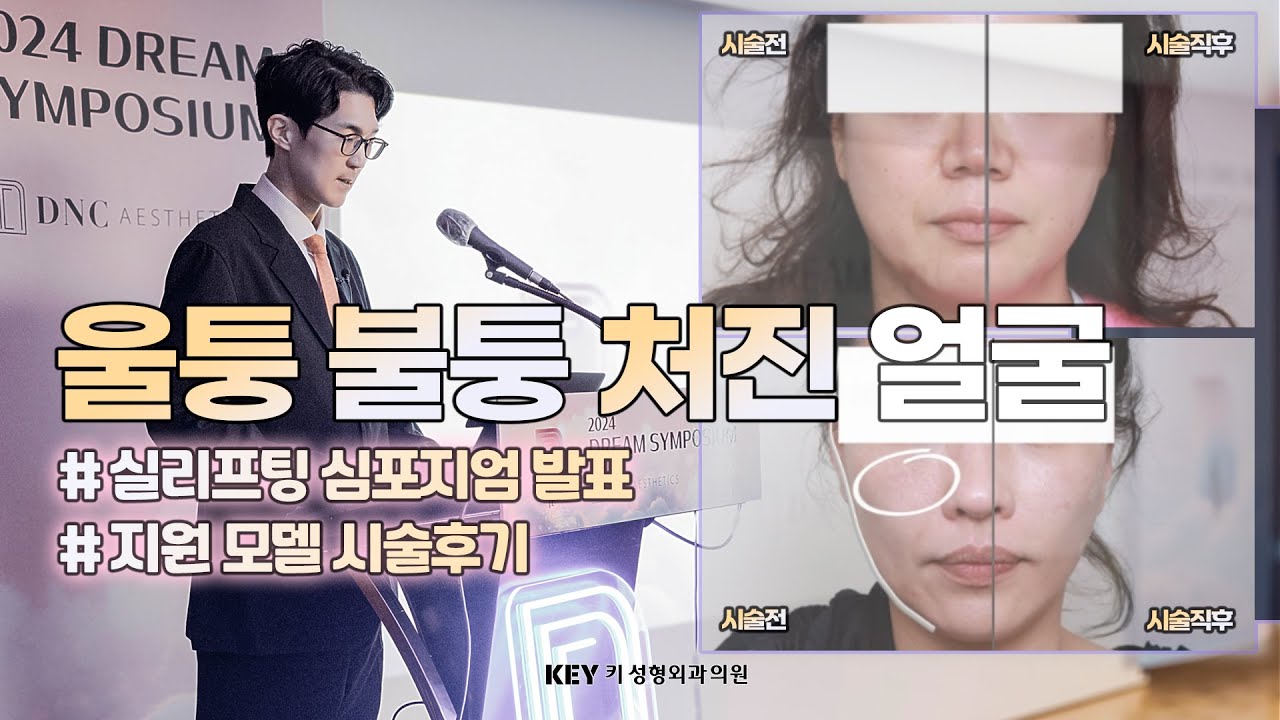 대구실리프팅 강력하고 오래가는 리프팅을 위해서 ︎실리프팅 세미나 발표후기 ︎ 대구실리프팅 실리프팅 실리프팅잘하는곳