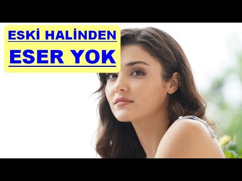 Hande Erçel Estetik Harikası Çıktı! Eski Halinden Eser Yok!