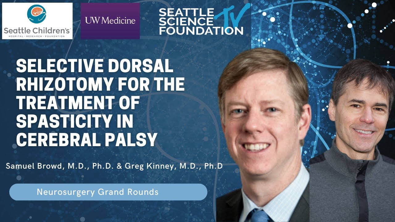 Selective Dorsal Rhizotomy for the Treatment of Spasticity in Cerebral ...